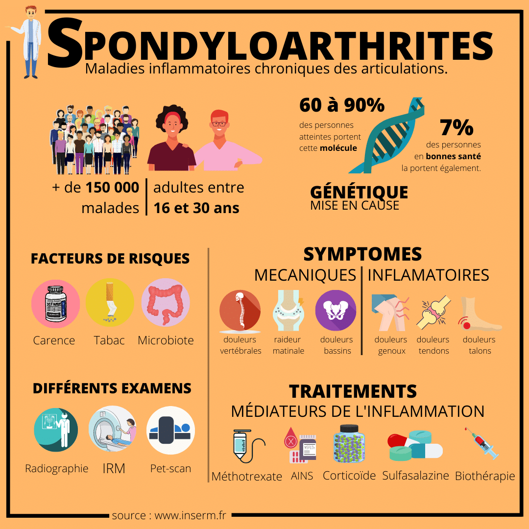 Spondylarthrite : symptômes, causes, traitements possibles