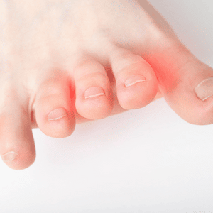 Polyarthrite Rhumatoïde : Symptômes, Causes & Traitements